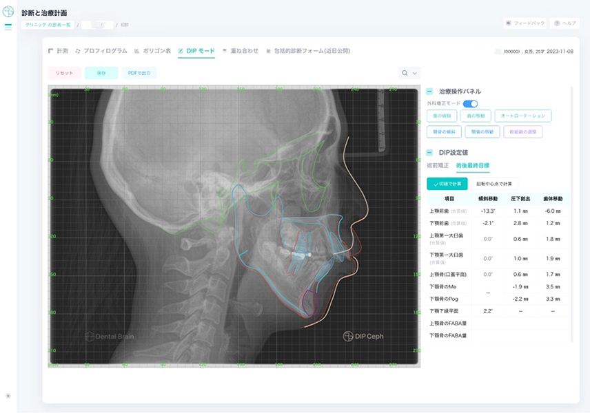 DIP Ceph｜AIが変える矯正歯科の未来